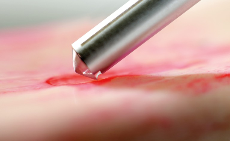 Micross® – Dentalmax